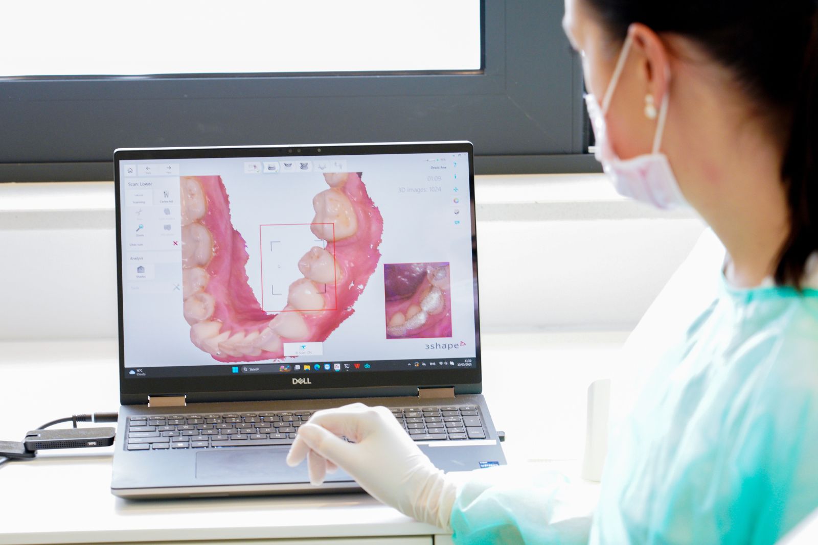 Najnaprednija dentalna dijagnostika: Kako u Poliklinici Rident ...