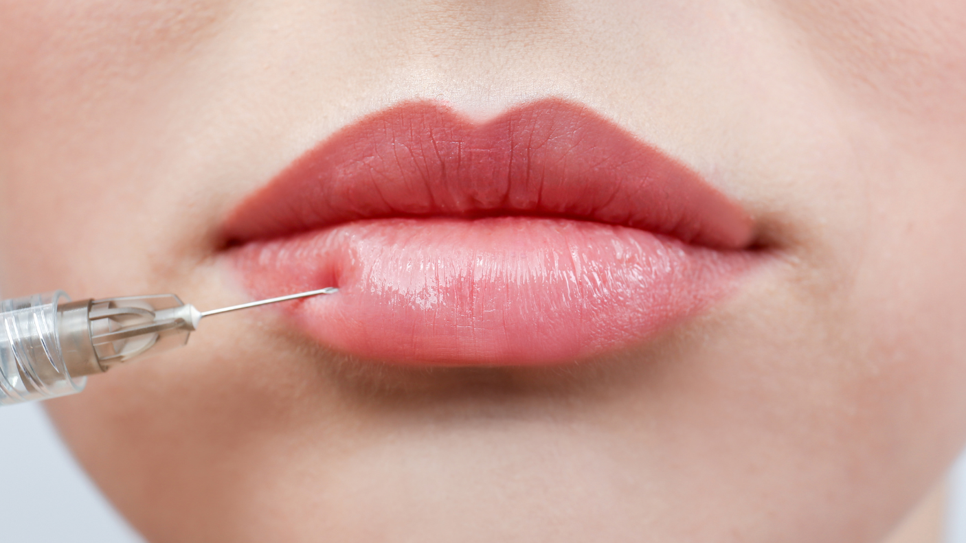 Kako se radi ortopan snimak? | ARENA DENTAL